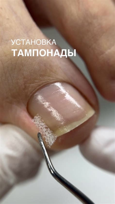 ПЕДИКЮР КУРСЫ ОБУЧЕНИЕ СЕРГИЕВ ПОСАД | ЧИТАЙ ОПИСАНИЕ ⬇️⬇️⬇️ В каких ...