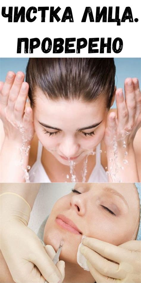 Whiteheads, Remedies, Nose, Plain, Skin Care, Adolescence, Lucky, Home ...