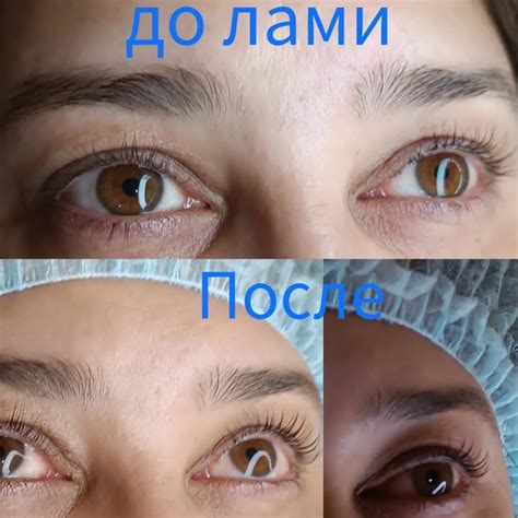 Привет! Давайте знакомиться! Я Алла, Косметолог-эстетист , мастер ...