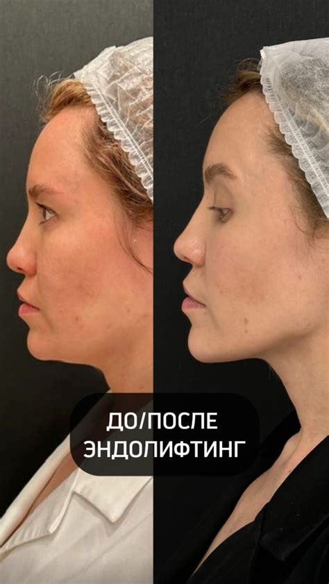 Врач-косметолог Анастасия Шарова (@doctor_sharova) • Instagram photos ...