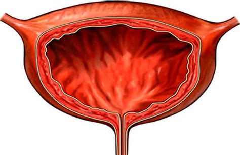Sistit xəstəliyi haqqında I Urologiya-andrologiya.az