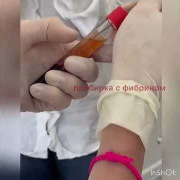 Плазмолифтинг Regenlab 3 пробирки - YouTube
