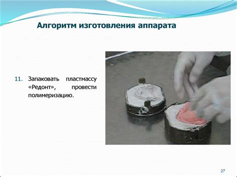 Ортодонтические аппараты - презентация онлайн