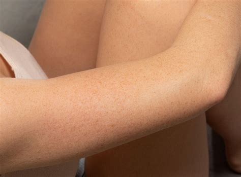 Sebiaclear – Laboratoire SVR USA