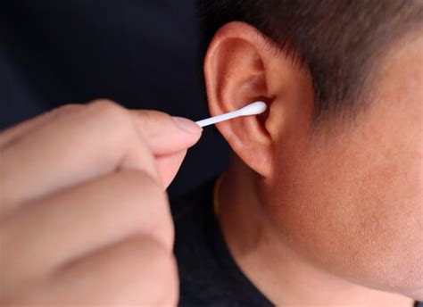 รูปภาพCerumen – เลือกดูภาพถ่ายสต็อก เวกเตอร์ และวิดีโอ7,817 | Adobe Stock