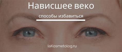 5 способов избавиться от нависшего верхнего века