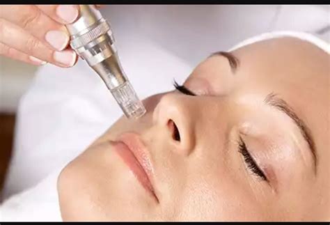 Dermapen Application – Private Dr. Hakan ERBİL Ümitköy Polyclinic