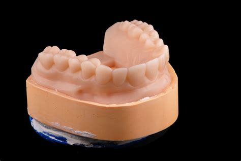 Сплинт каппа Cad/Cam | зуботехническая лаборатория Dentservice