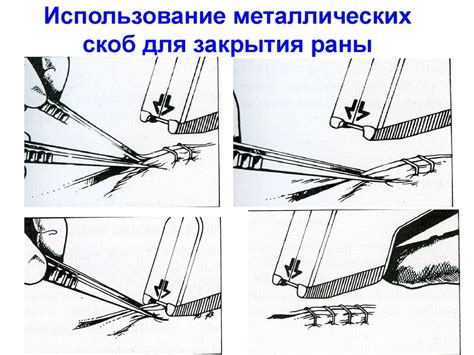 Общая анестезия. Оперативные способы закрытия раневого дефекта ...
