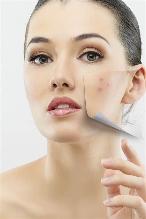 5 of the best beauty buys for blemishes
