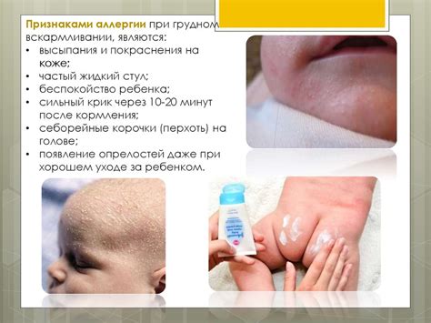 Питание кормящей мамы - презентация онлайн