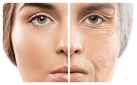 Wrinkle Reduction - Elyzee Day Surgery Medical Center L.L.C