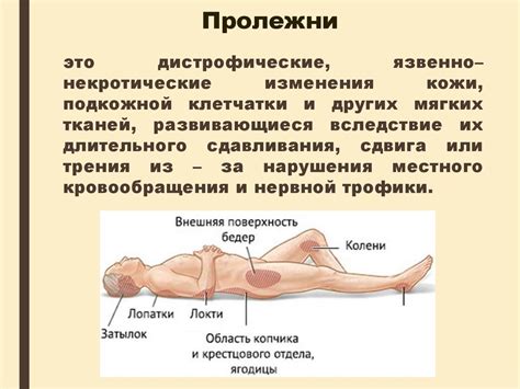 Паллиативный сестринский уход при кожных проявлениях. Основные подходы ...
