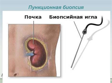 Биопсия. Виды биопсии - презентация онлайн