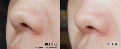 Review: Tosowoong Special Edition Cocoon Monster Pack (Pore Tightening ...