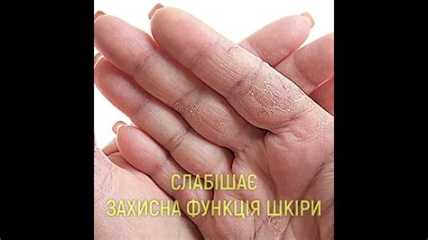 АЕвіт ПРЕМІУМ та антисептики - YouTube