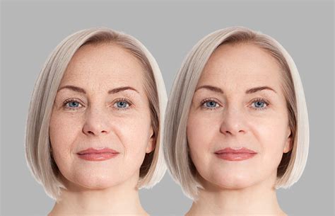 Lifting Face Treatment - Babor Kosmetikinstitut Köln