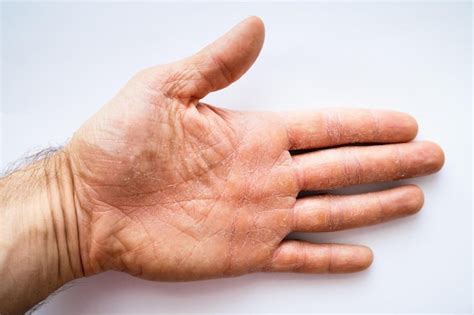 Premium Photo | Dry man hand