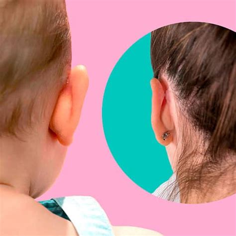 Otostick Baby - Otostick USA | Aesthetic Ear Corrector