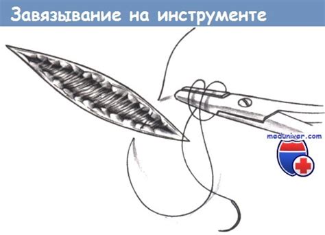Техника вязания узлов в хирургии