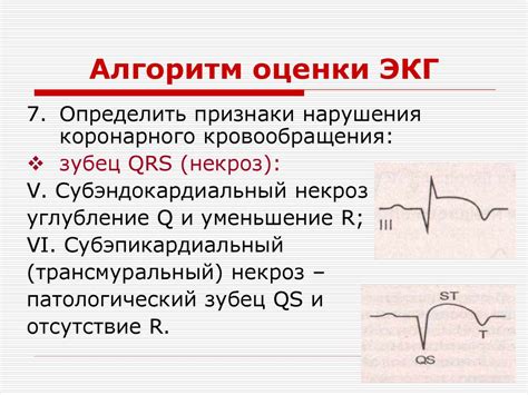 ЭКГ в норме и патологии - презентация онлайн