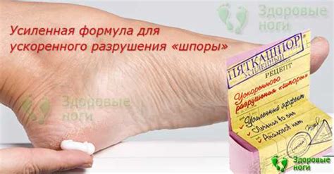 Мазь от шпор на пятках отзывы – лучшая мазь для лечения пяточной шпоры ...