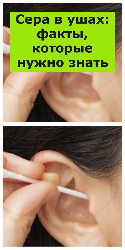 Сера в ушах: факты, которые нужно знать Источник:... | Интересный ...