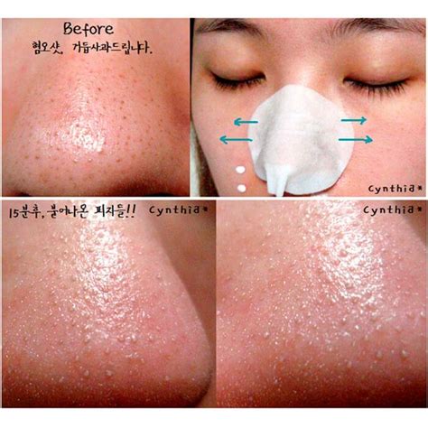 Салфетки от чёрных точек Ciracle Pore Control Blackhead Off Sheet ...