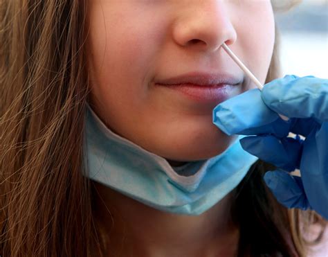 What Are You Doing Now That Accula™ Is Going Away? — Anavasi Diagnostics