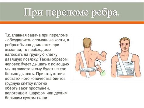 Наложение повязки при переломе ребра: как сделать корсет из бинта