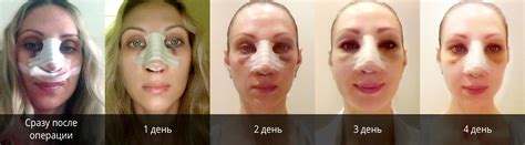 Ринопластика: правила выбора пластического хирурга — Всё для леди