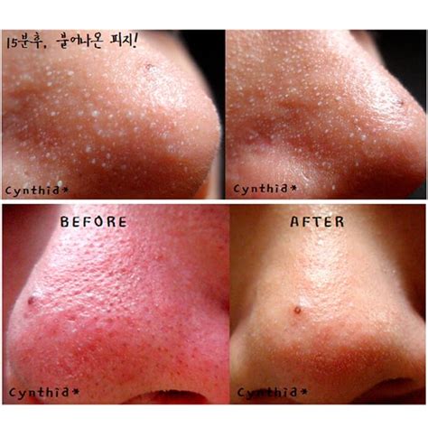 Салфетки от чёрных точек Ciracle Pore Control Blackhead Off Sheet ...