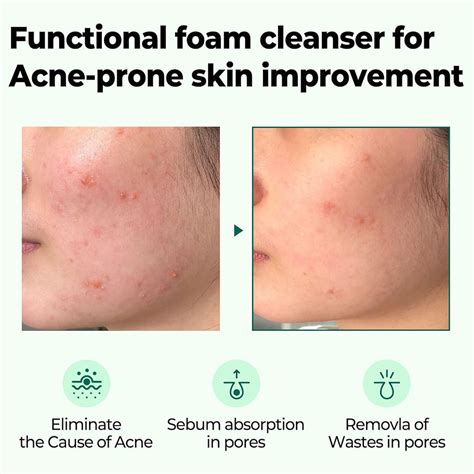 Some by mi aha bha pha 30 days miracle acne clear foam | ColorShow