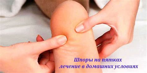 Шпоры на пятках лечение в домашних условиях