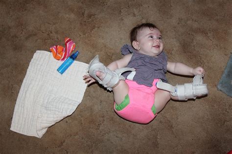 Froggied Princess: Our life with a Wheaton-Pavlik Harness: Diapering ...