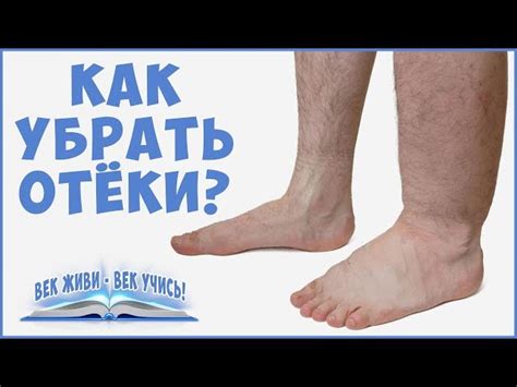 Средство от отеков ног: какой противоотечный препарат лучше принимать