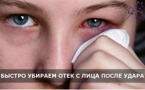 Как быстро снять отек с глаз: причины и лечение отека глаз