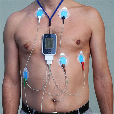 Prenotazioni Holter Cardiaco Latina | Poliambulatorio Physiofit