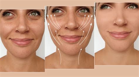 Lipolytic Injections | ZiClinic