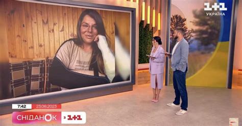 Ведуча 1+1 Шовкопляс з'явилася у прямому ефірі з розбитим обличчям ...