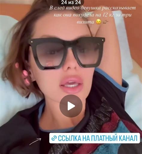 Виктория Боня показала "лисьи глазки" после операции - TOPNews.RU
