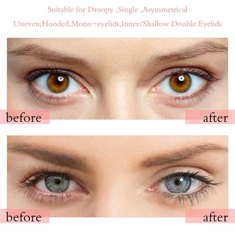 What Are The Different Types Of Eyelids? How To Determine Yours Easy Eye Makeup Tips | atelier ...