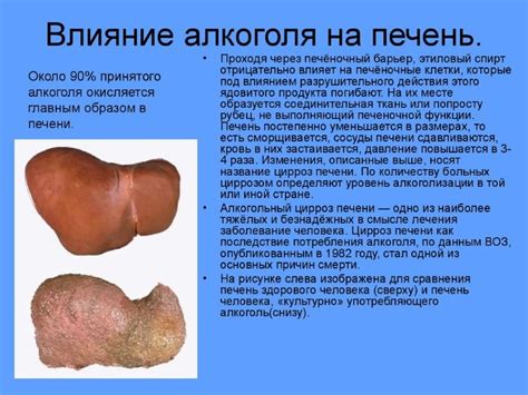 Лекарства для печени после алкоголя: чем лечить
