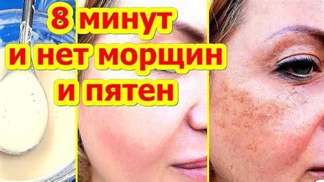 За 8 Минут Убрала Морщины и Пятна! Маска от Глубоких Морщин для Лица ...