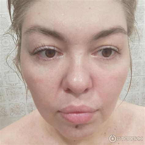 Отзыв о Пилинг для лица Profka с гликолевой кислотой | Пилинг который ...