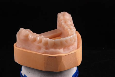 Сплинт каппа Cad/Cam | зуботехническая лаборатория Dentservice