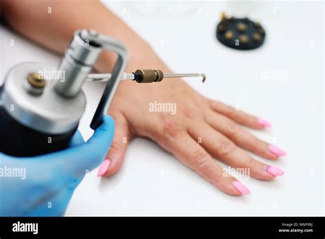 Wart removal hi-res stock photography and images - Alamy