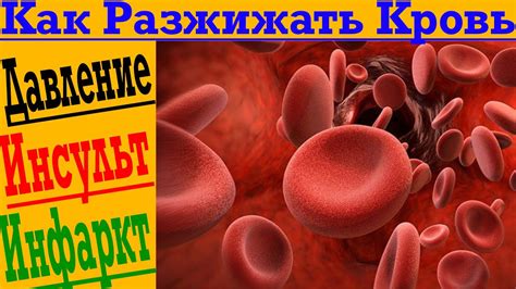 Как разжижать кровь и понизить давление?! Риск инфаркта и инсульта ...