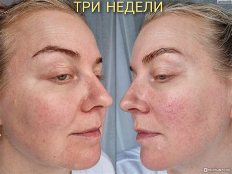 Антивозрастной крем для лица L'Oreal Paris Возраст Эксперт здоровое ...