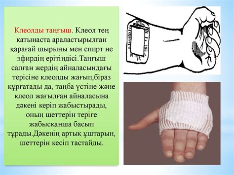 Десмургия. Десмургия дегеніміз - презентация онлайн